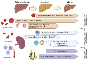 Anormalidades hematológicas en enfermedad hepática, fisiopatología y consideraciones terapéuticas