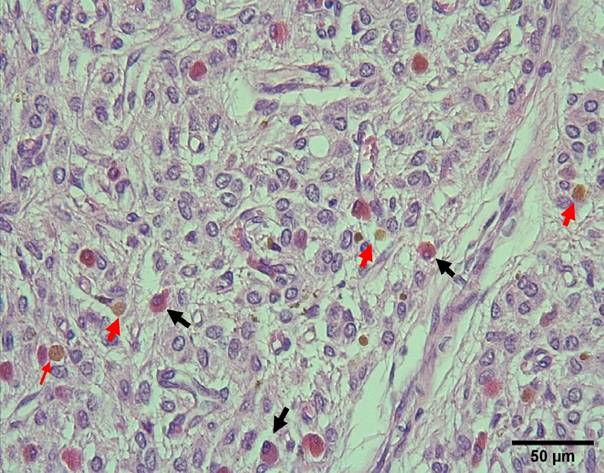 Histologia Da Glandula Pineal Anatomical, Scanning Electron
